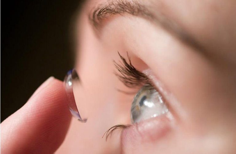 Contact lenses - what vision defects they correct - The Lovely Feathers